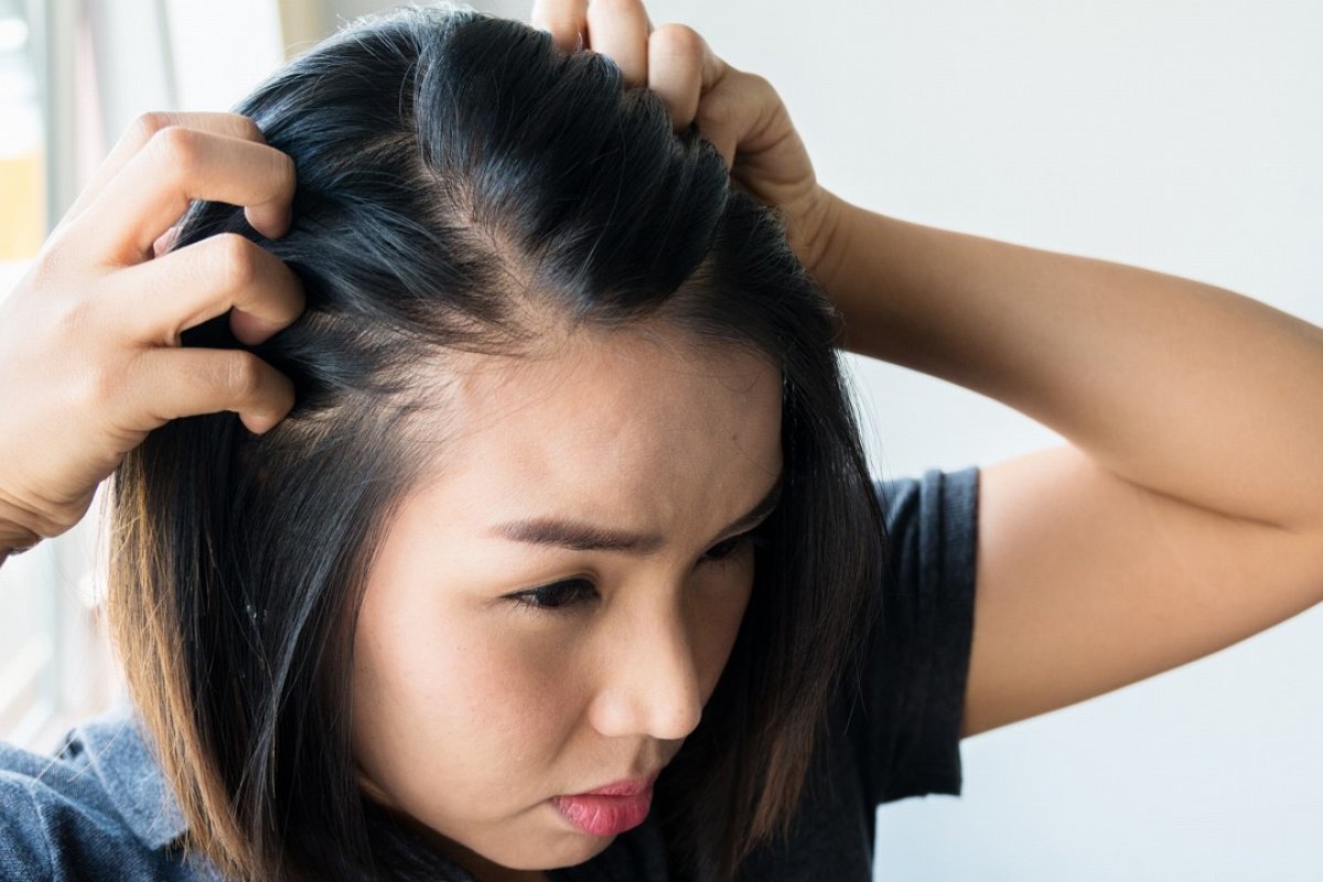 How To Prevent Hair Loss Regrowth Your Source Of Hair News